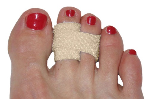 TOE FRACTURE | Expert In Feet Dr. Daniel Drapacz