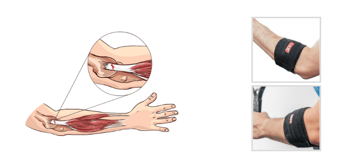 3pp® Elbow POP™ Splint | 3 Point Products
