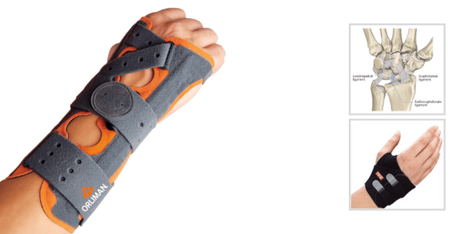 Orthotic Management Of The Distal Radioulnar Joint (DRUJ)