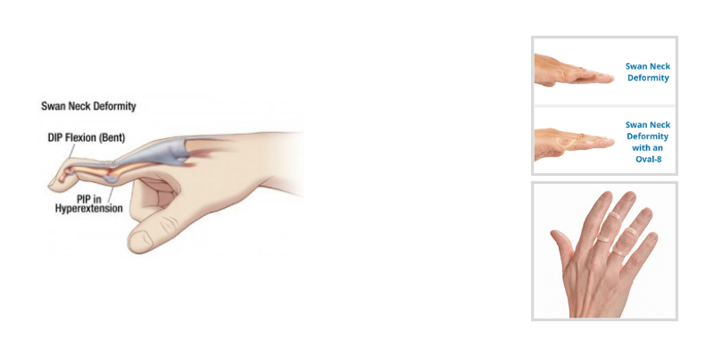 Healthcare Blog | 3-Point Products