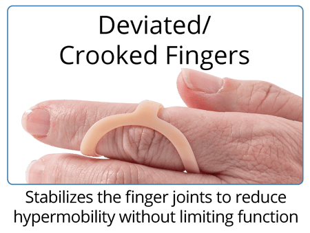 The Original Oval-8 Finger Splints | 3-Point Products