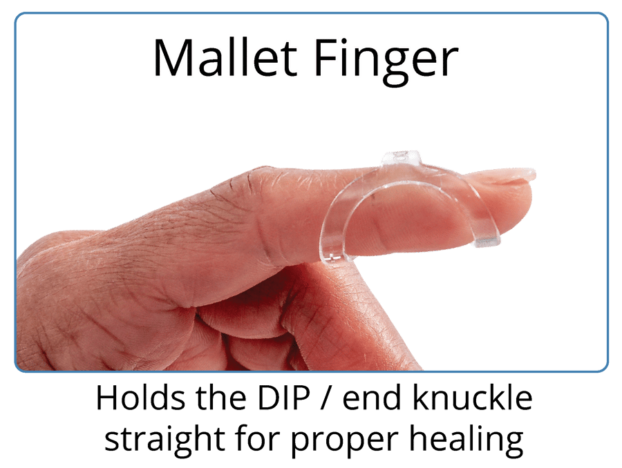 The Original Oval-8 Finger Splints | 3-Point Products