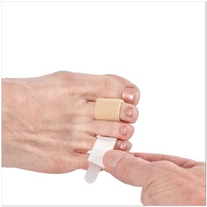 Using a 3pp Toe Loop to Treat a Jammed or Broken Toe- Updated 2023