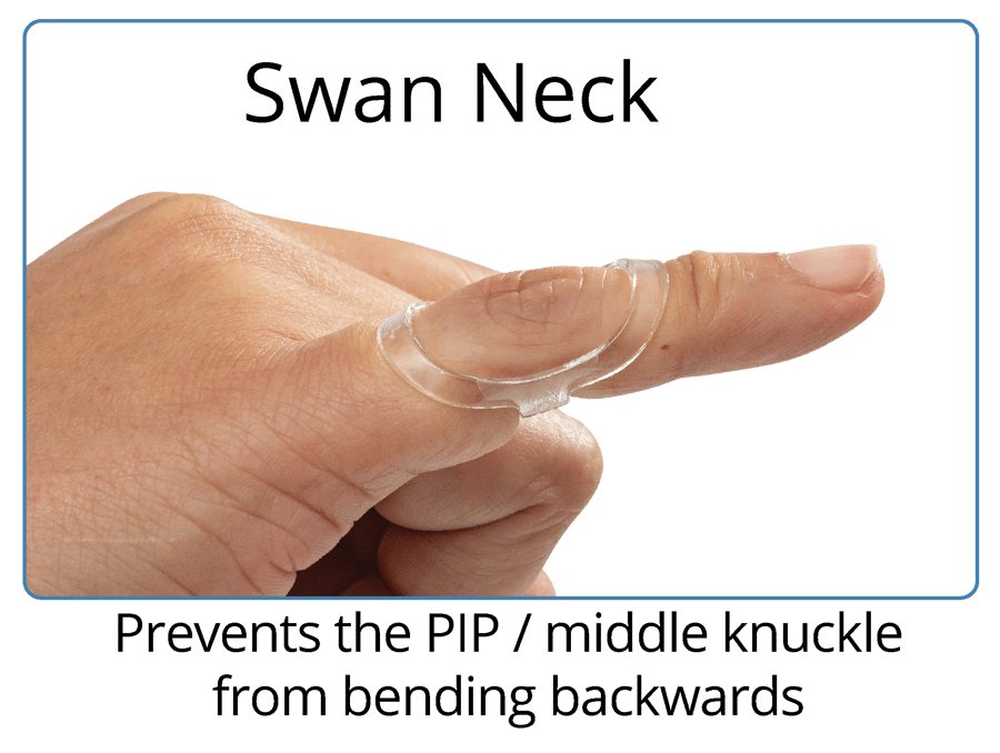 The Original Oval-8 Finger Splints | 3-Point Products