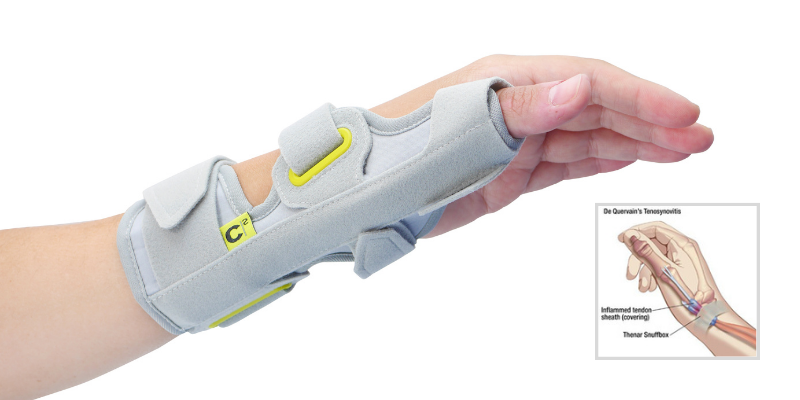 Thumb Spica Splint For De Quervains