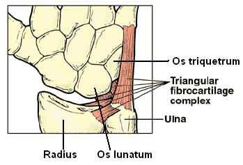 TFCC Ulnar Sided Wrist Pain - Anatomy, Diagnosis & Treatment