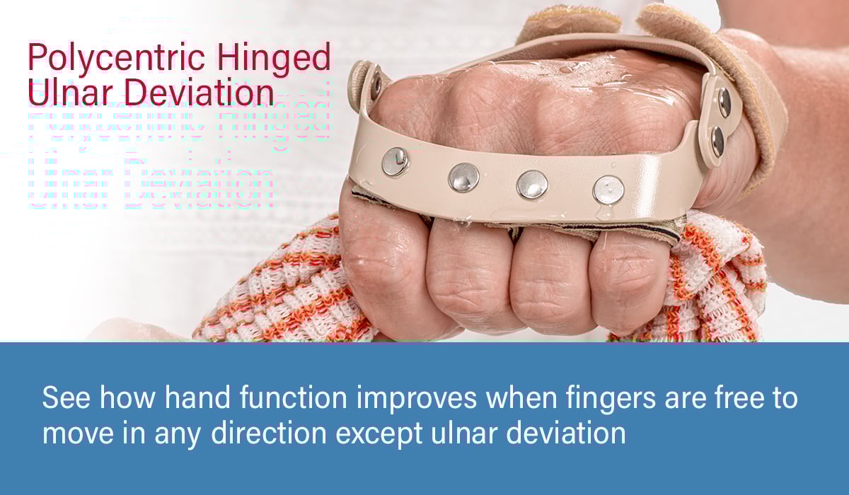 3-Point Products | Hand, Foot & Arthritis Splints & Braces